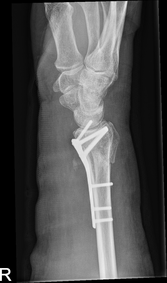 Hand – Sportarzt Dr. Philipp Schultes